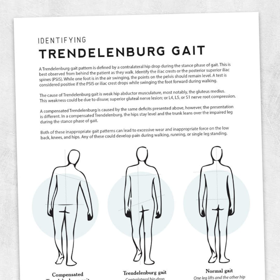 Identifying Trendelenburg Gait - Etsy