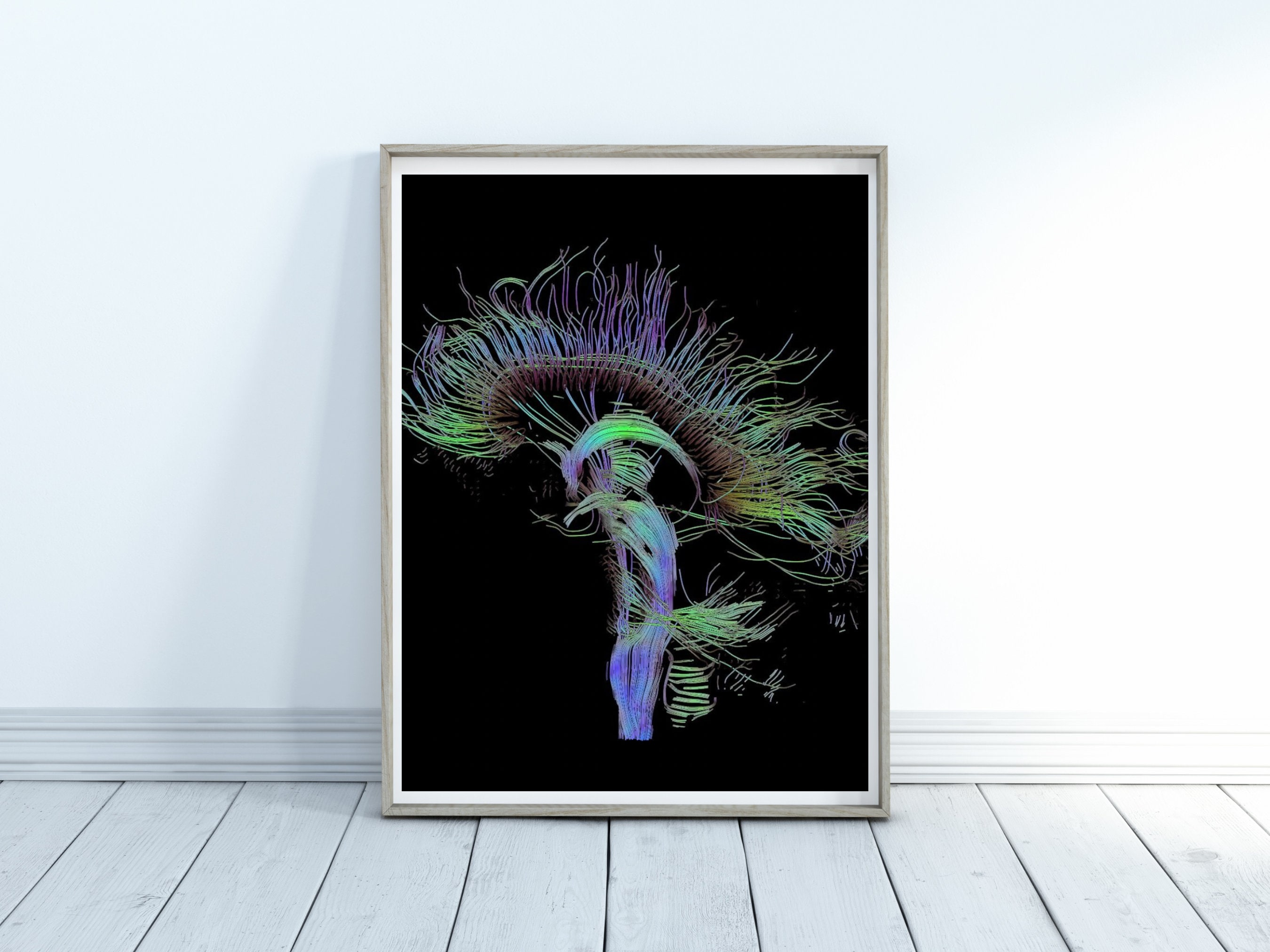 Brain Fibers- DTI Imaging Technology Print DIGITAL DOWNLOAD - Etsy