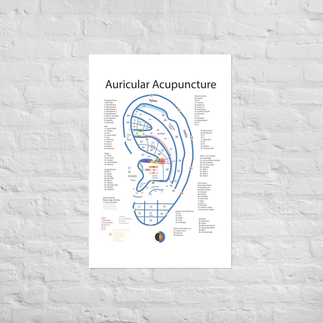 Auricular Acupuncture Poster - Etsy