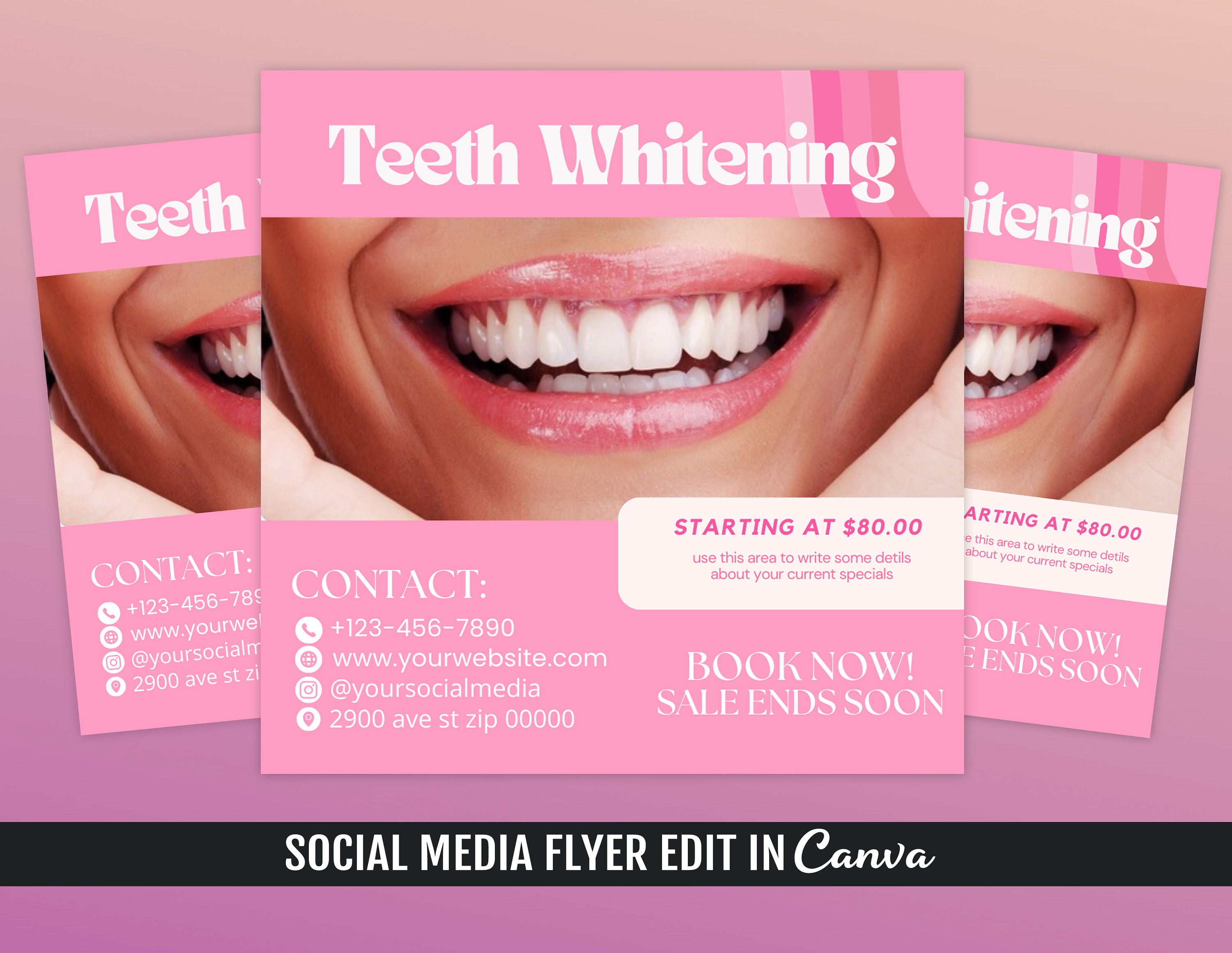 Teeth Whitening Flyer Template - Etsy
