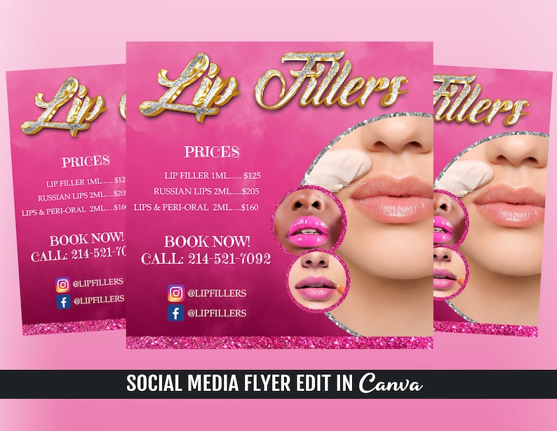 Lip Fillers Flyer Template - Etsy