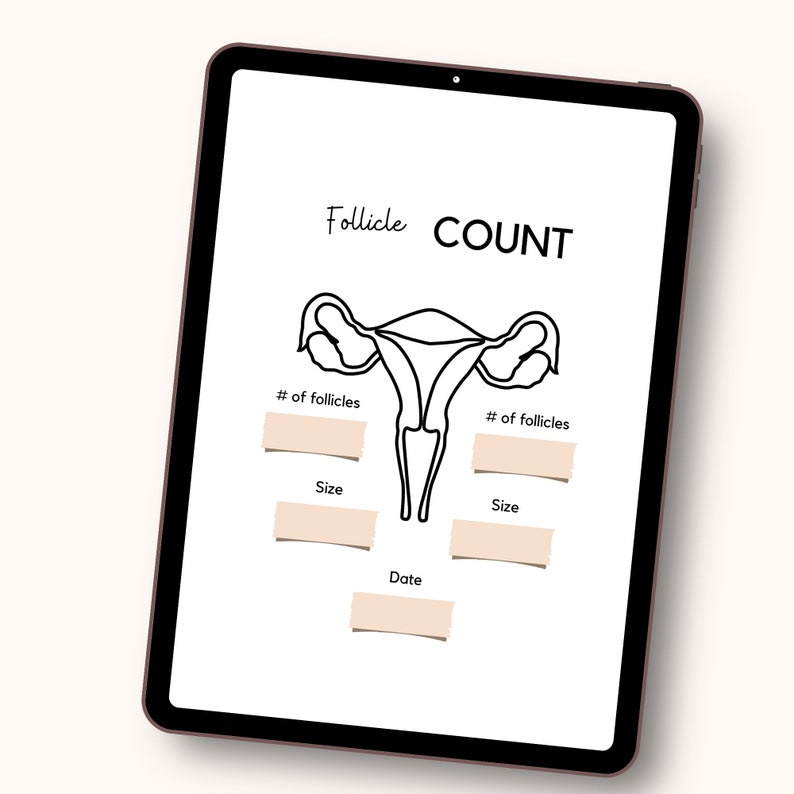 PLR Digital Planner, Private Label Resell Rights, IVF Digital Planner ...