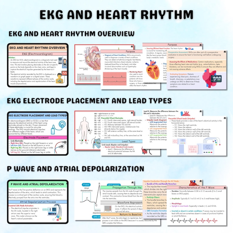 150+ EKG and Heart Rhythm Flashcards | EKG Study Guide | ECG or Ekg ...