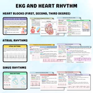 150+ EKG and Heart Rhythm Flashcards | EKG Study Guide | ECG or Ekg Interpretation | Cardiac ...