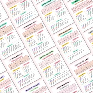 ECG Rhythm & Arrhythmias Cheat Sheet | ECG Study Guide | Nursing Notes ...