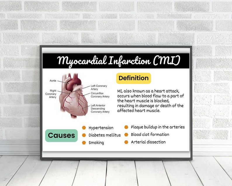 15 Cardiovascular Flashcards Printable | Nursing Students Notes ...