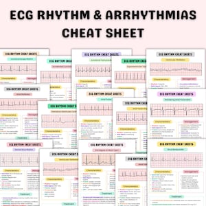 Cardiac Bundle | Cardiac Nursing Notes | ECG Rhythm & Arrhythmias ...