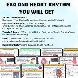 150+ EKG and Heart Rhythm Flashcards | EKG Study Guide | ECG or Ekg Interpretation | Cardiac ...