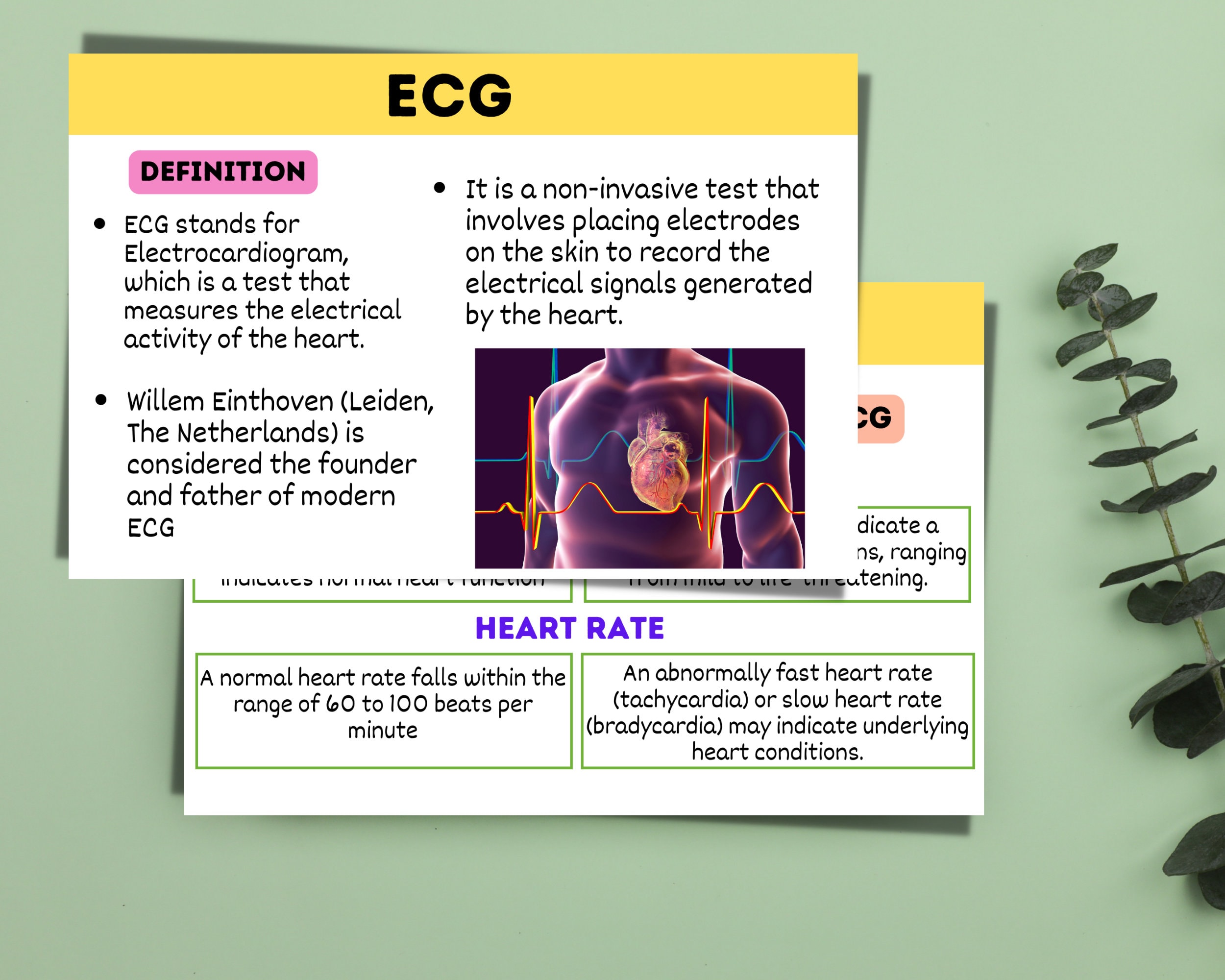 ECG Flashcards Printable for Nursing Students Cardiovascular - Etsy