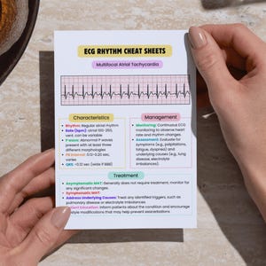 ECG Rhythm & Arrhythmias Cheat Sheet | ECG Study Guide | Nursing Notes ...