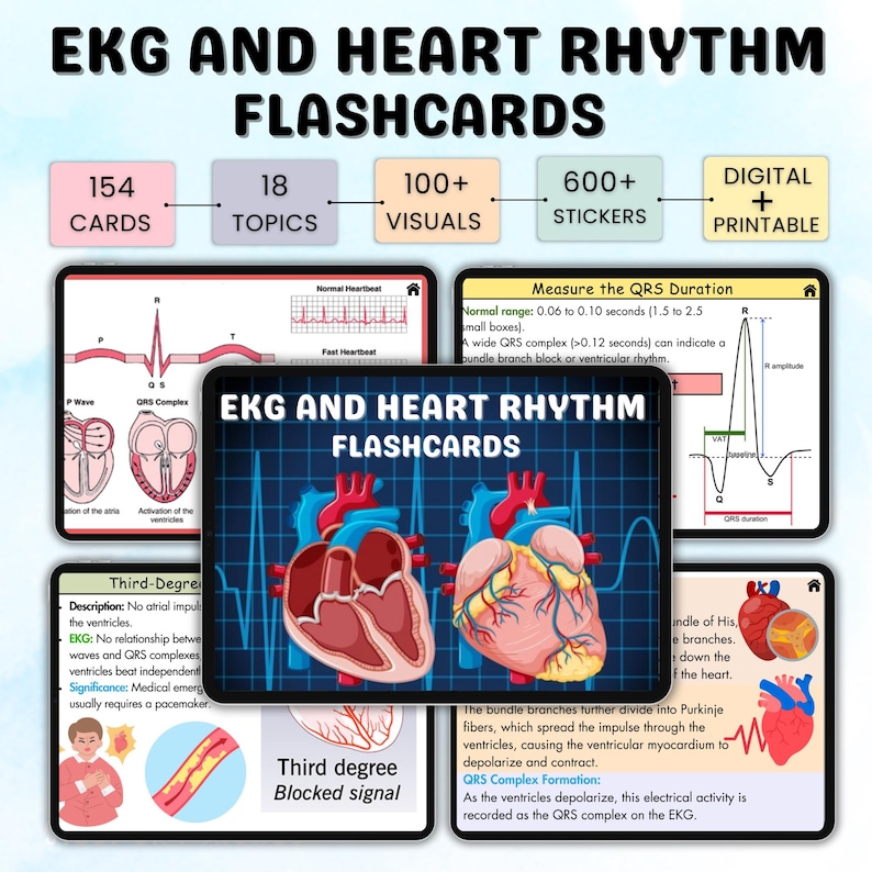 150+ EKG and Heart Rhythm Flashcards | EKG Study Guide | ECG or Ekg ...