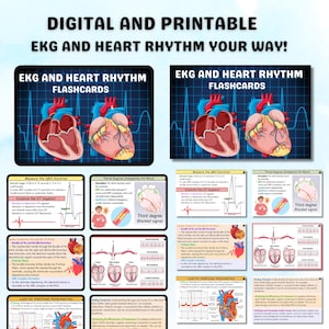 150+ EKG and Heart Rhythm Flashcards | EKG Study Guide | ECG or Ekg Interpretation | Cardiac ...