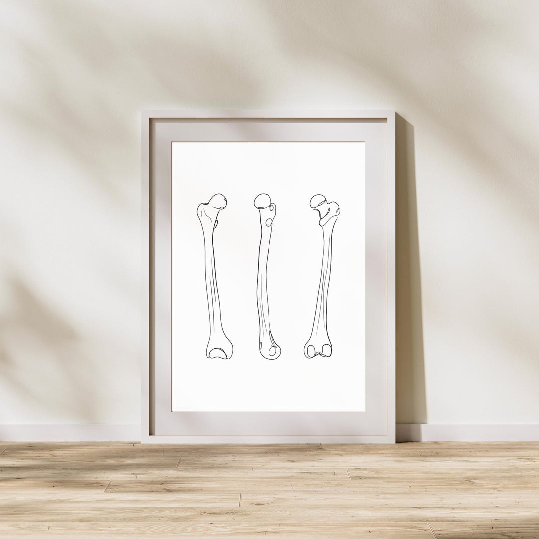 Femur Anatomy Art Print: Medical Office Decor (digital Download) - Etsy UK