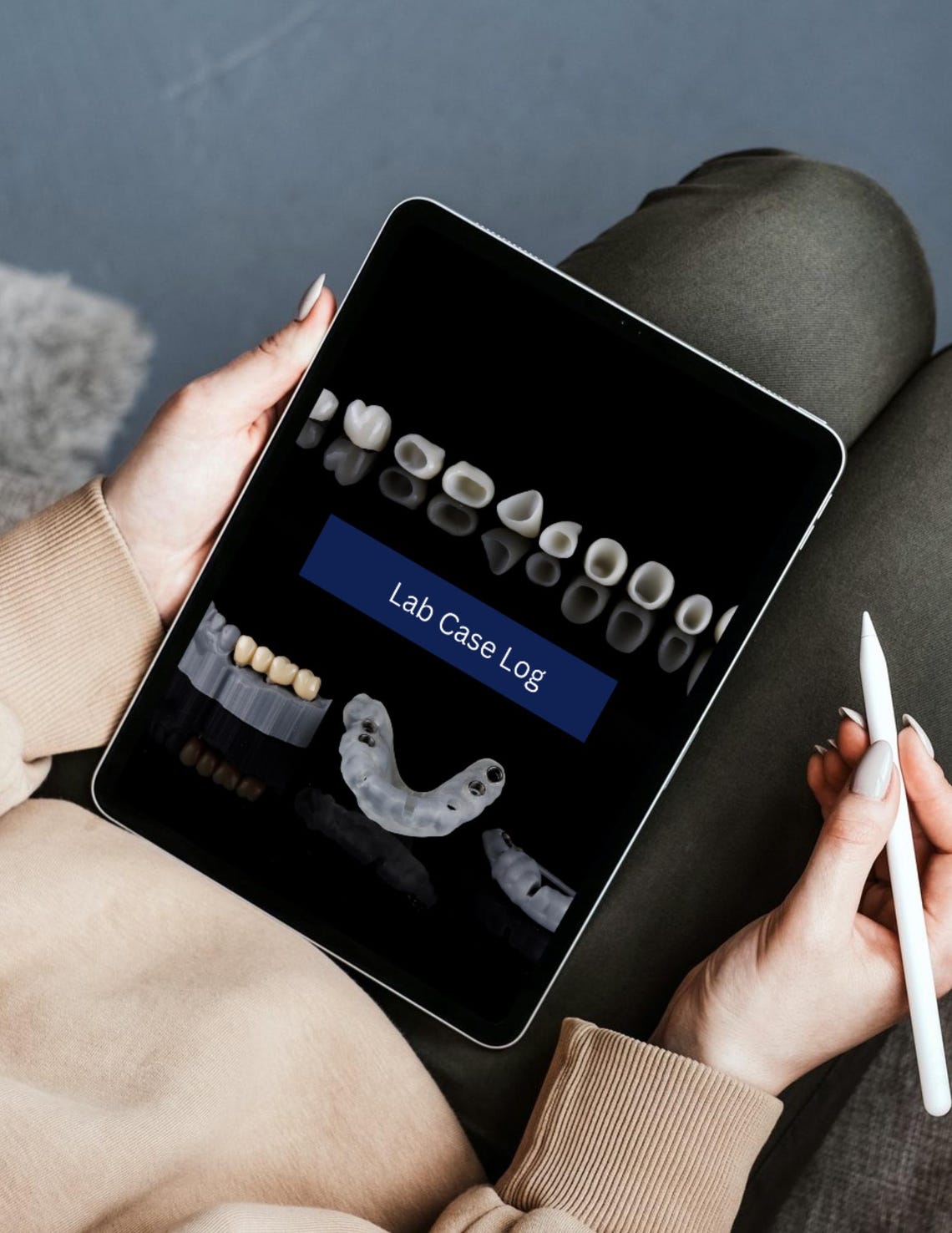 Dental Lab Case Manager for the Dental Office - Etsy