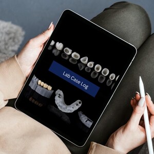 Dental Lab Case Manager for the Dental Office - Etsy