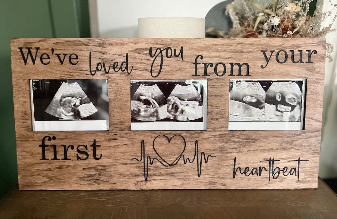 Ultrasound Frame Sonogram Frame Heartbeat Picture Photo Frame Baby Scan ...