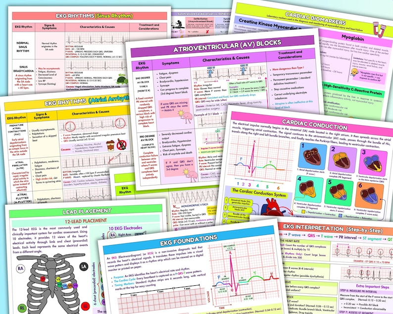 EKG Rhythms & Dysrhythmia Cheat Sheet Bundle, Nursing School Study ...