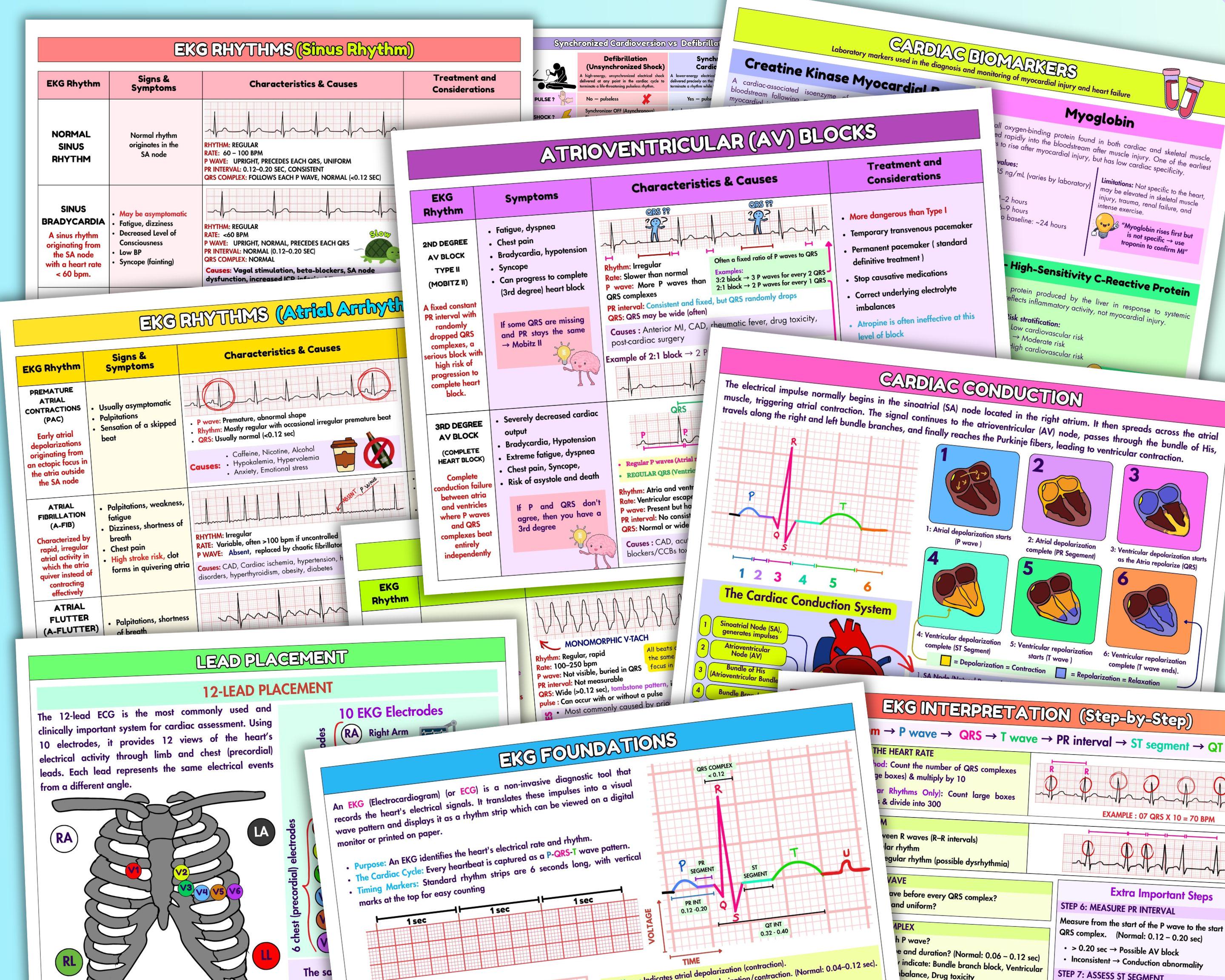 EKG Rhythms & Dysrhythmia Cheat Sheet Bundle, Nursing School Study ...