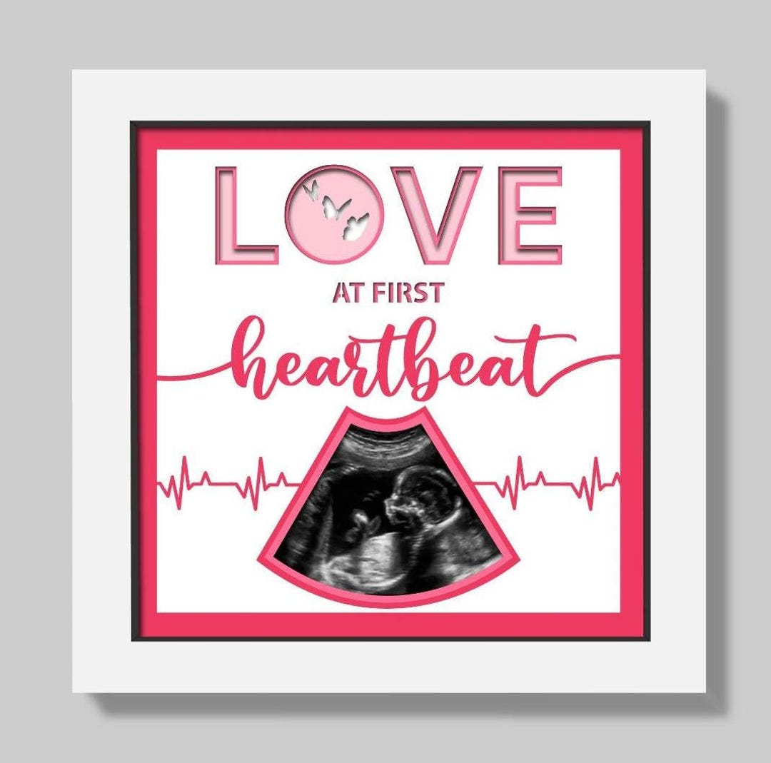 Baby Personalised Ultrasound Shadow Box, Ultrasound Display, Baby ...