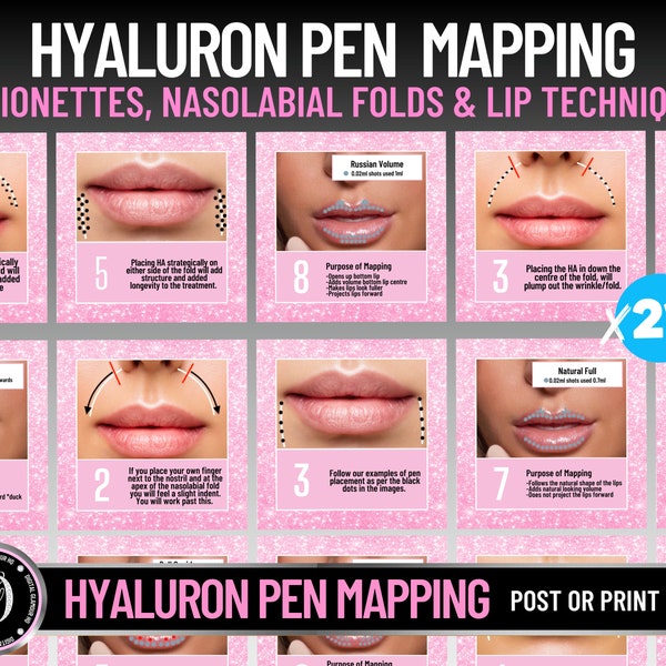 Marionette Lines Map - Etsy