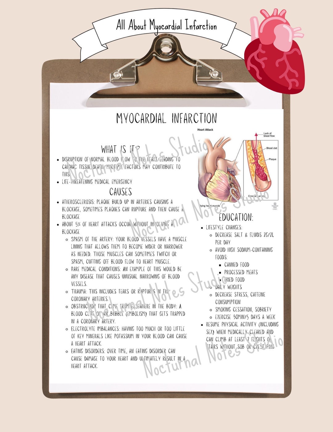 All About Myocardial Infarction, Nursing Student, Cardiac Nurse, New ...