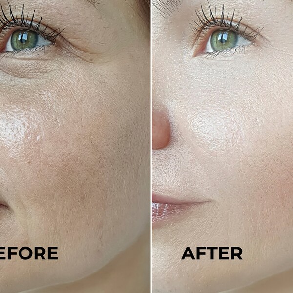 Wrinkle Cream - Etsy