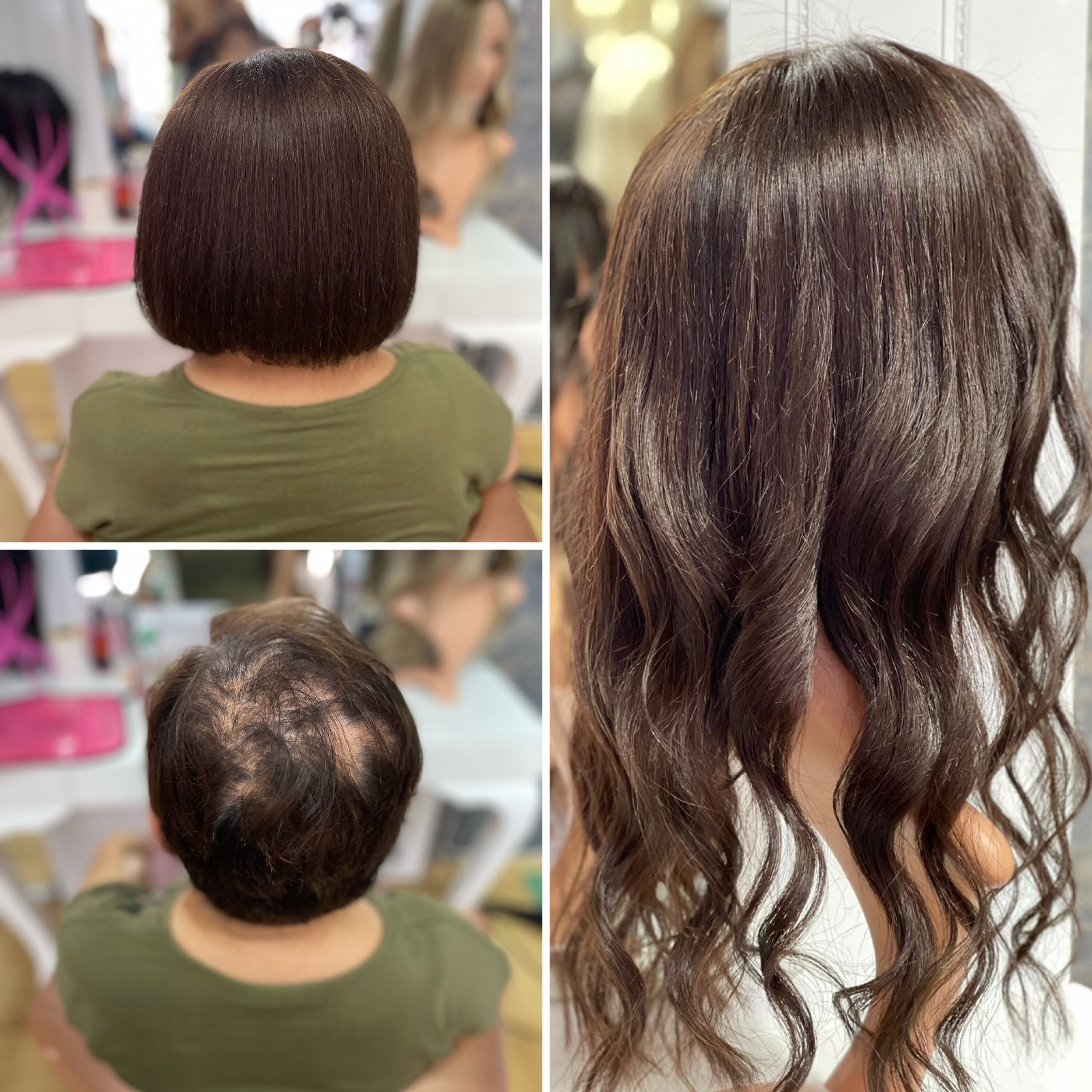Human Hair Toppers for Woman Lace Front Toppers Remy Hair Dark Brown ...