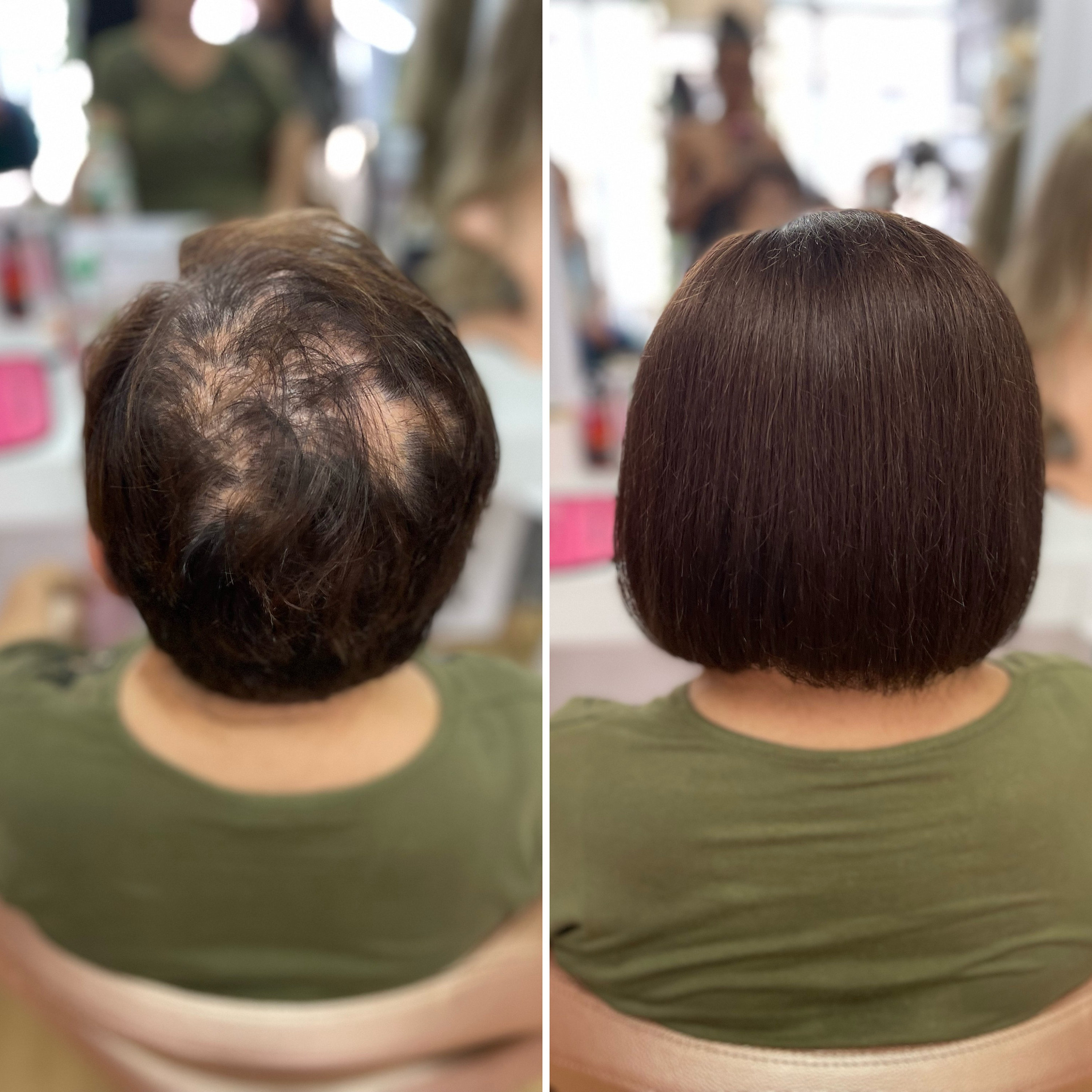 Human Hair Toppers for Woman Lace Front Toppers Remy Hair Dark Brown ...