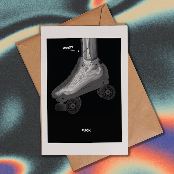 Broken Leg Card - Etsy