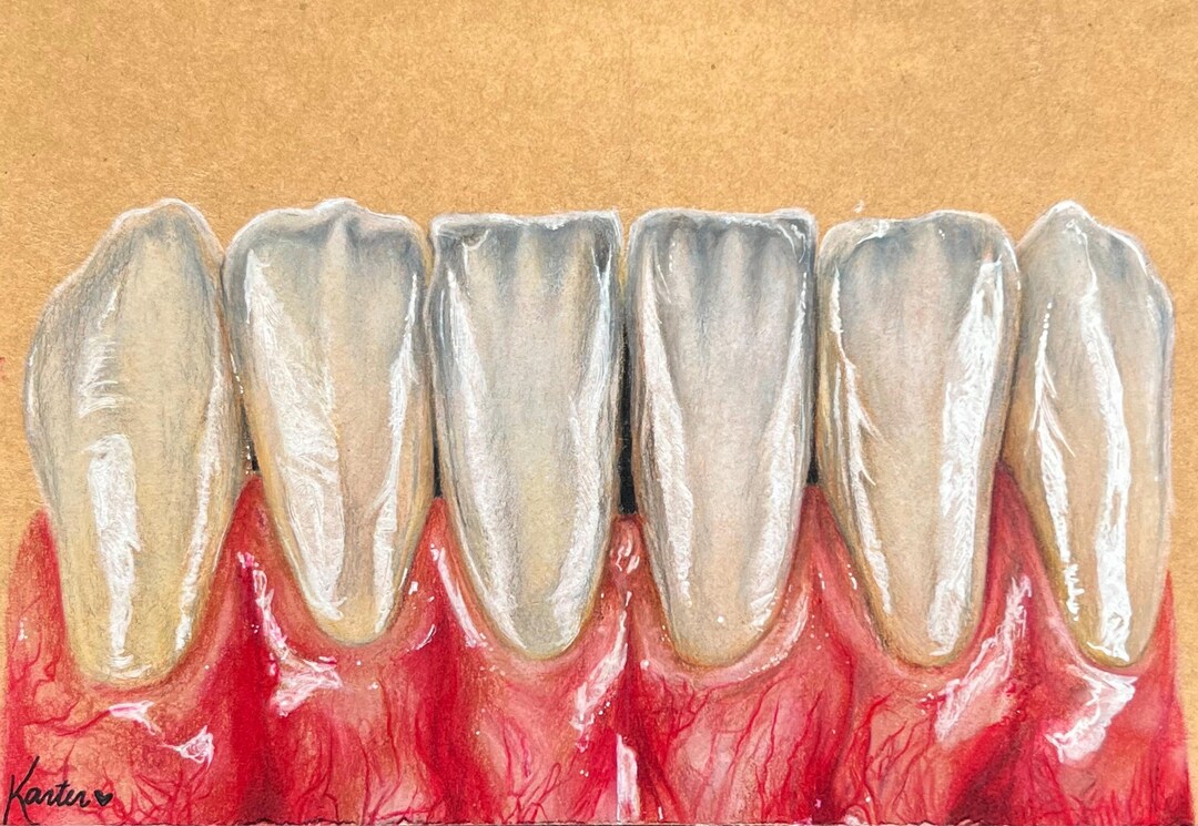 Front Bottom Teeth Art Print - Etsy