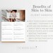 Editable Doula Handout, Benefits of Skin to Skin Printable, Handouts ...