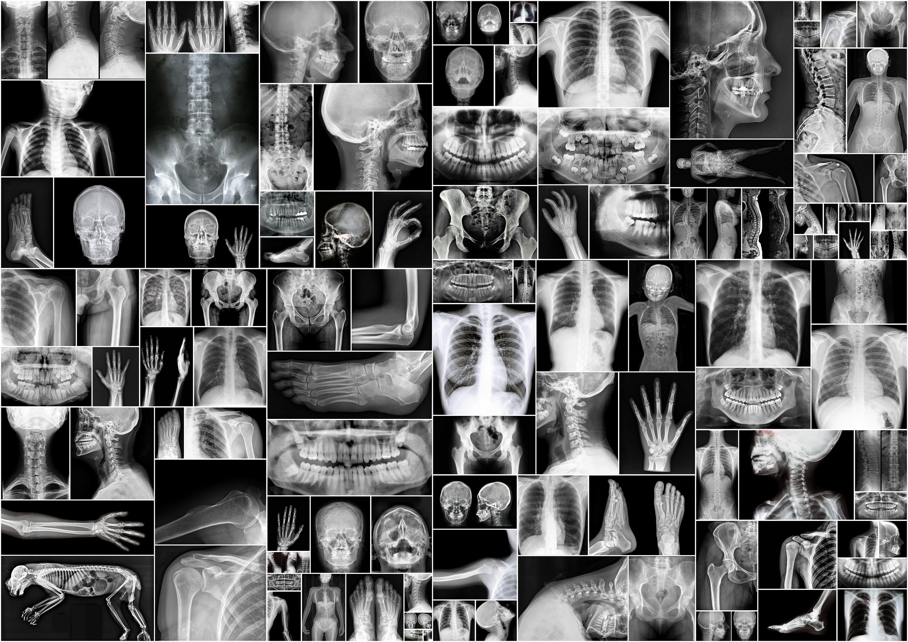 X Ray 100 Files Instant Downloads. Printable Tags Pages Paper Craft - Etsy