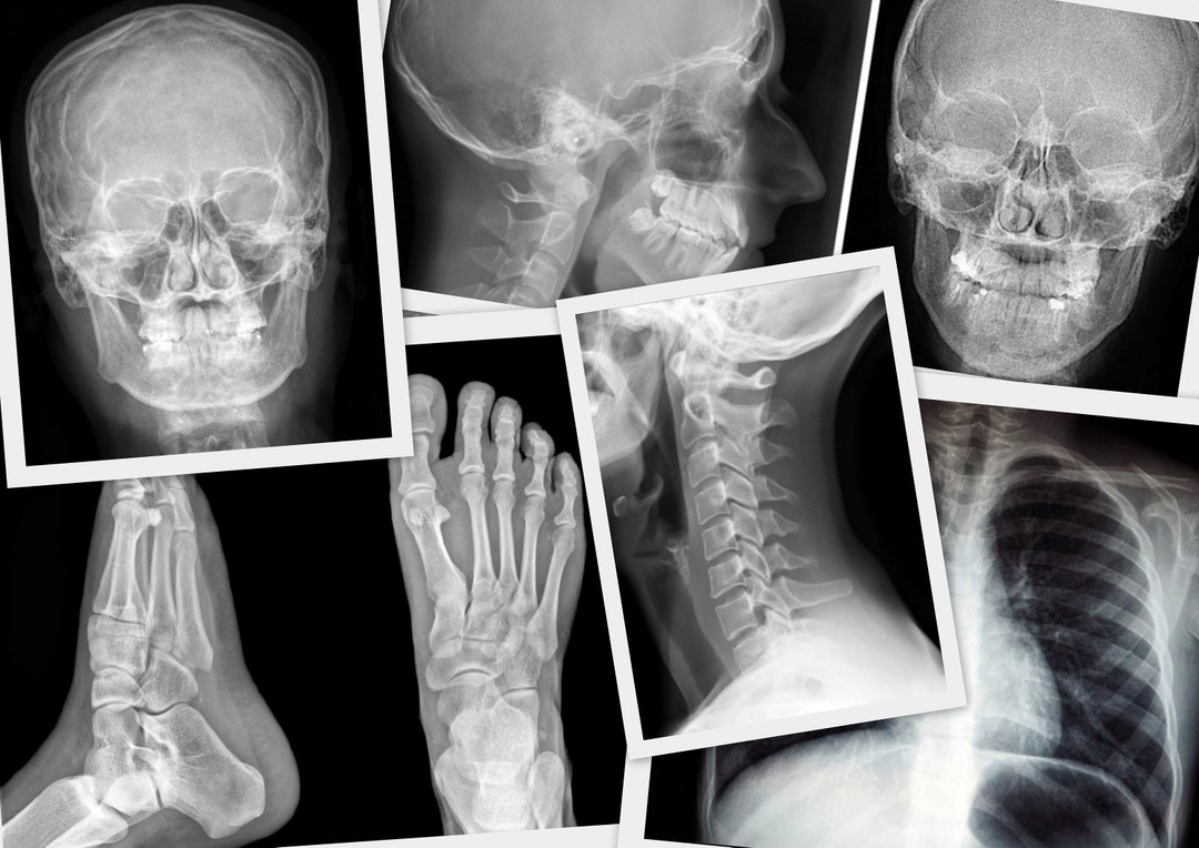 X Ray 100 Files Instant Downloads. Printable Tags Pages Paper Craft - Etsy