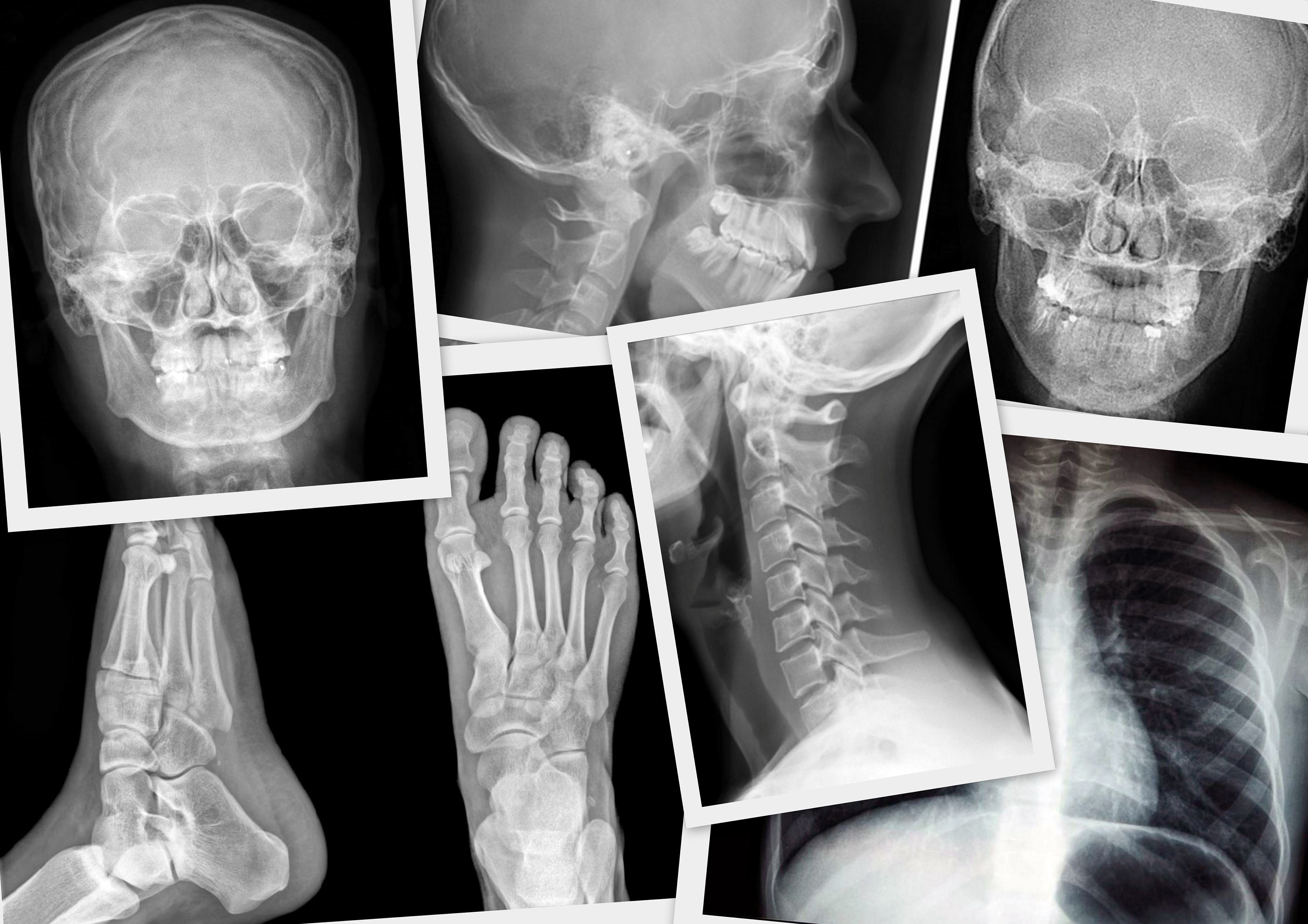 X Ray 100 Files Instant Downloads. Printable Tags Pages Paper Craft - Etsy