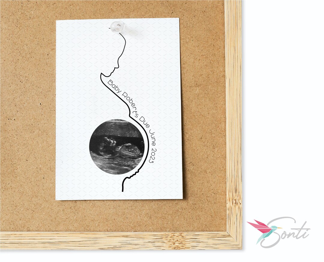 Printable Personalized Sonogram Frame Pregnancy Announcement Card ...