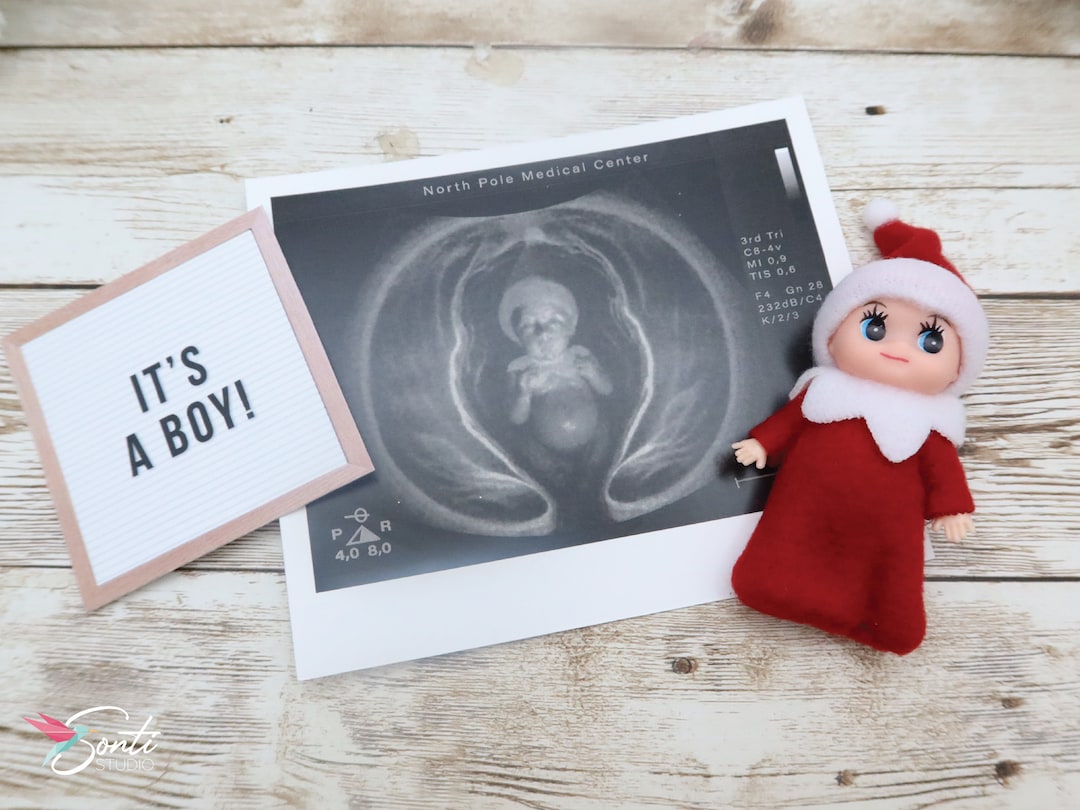 Christmas Elf Ultrasound, Elf Sonogram Announcement, Elf Baby, Elf Kit ...