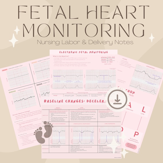 Nursing Notes Nursing Labor and Delivery Nursing OB Fetal - Etsy