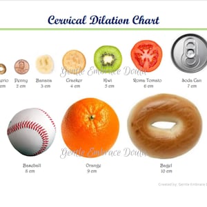 Cervical Dilation Chart, Cervix Chart, Doula, Midwife, Printable - Etsy ...