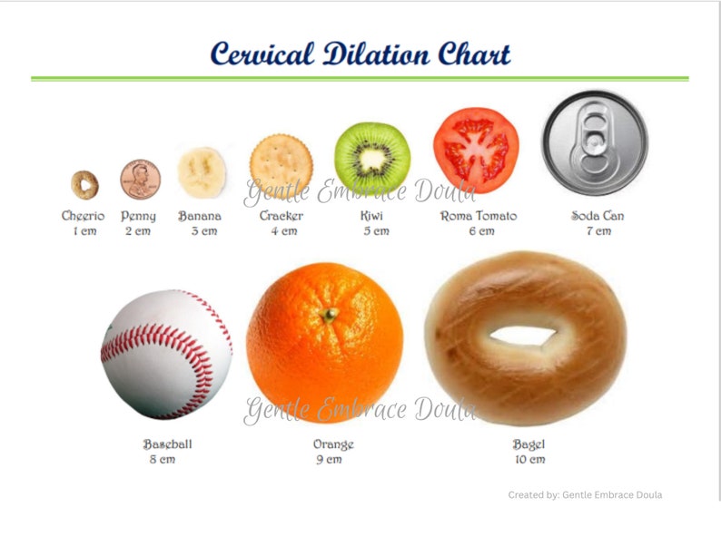 Cervical Dilation Chart Cervix Chart Doula Midwife - Etsy New Zealand Cervical Dilation Chart Cervix Chart Doula Midwife - Etsy New Zealand