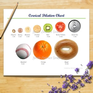 Cervical Dilation Chart, Cervix Chart, Doula, Midwife, Printable - Etsy