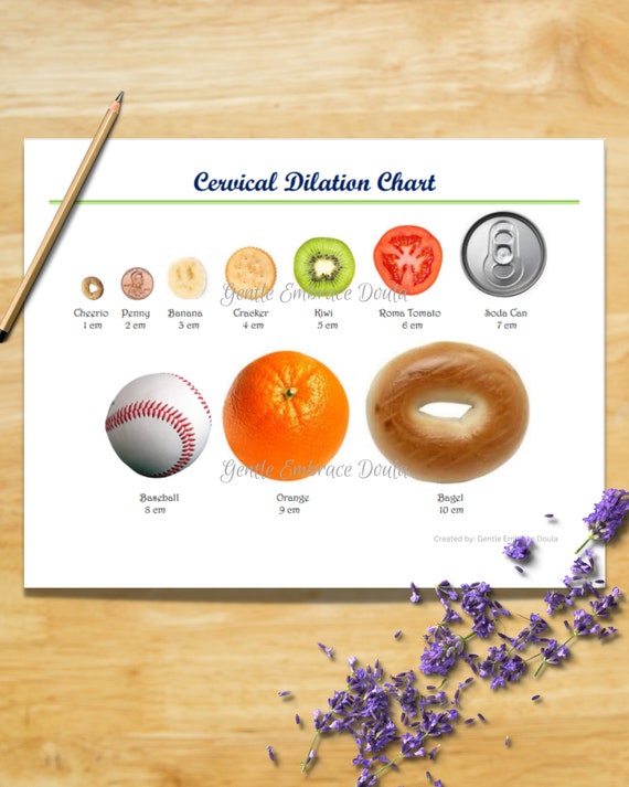 Cervical Dilation Chart Cervix Chart Doula Midwife - Etsy