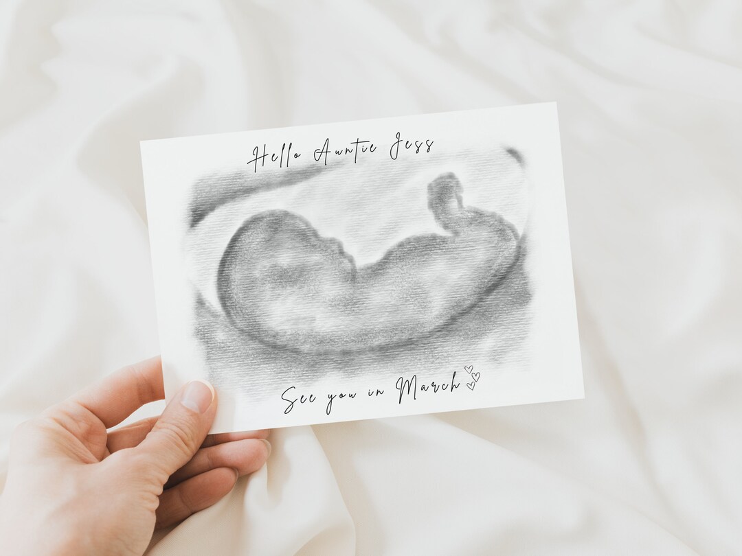Custom Ultrasound Scan Drawing | Pregnancy Announcement - Etsy
