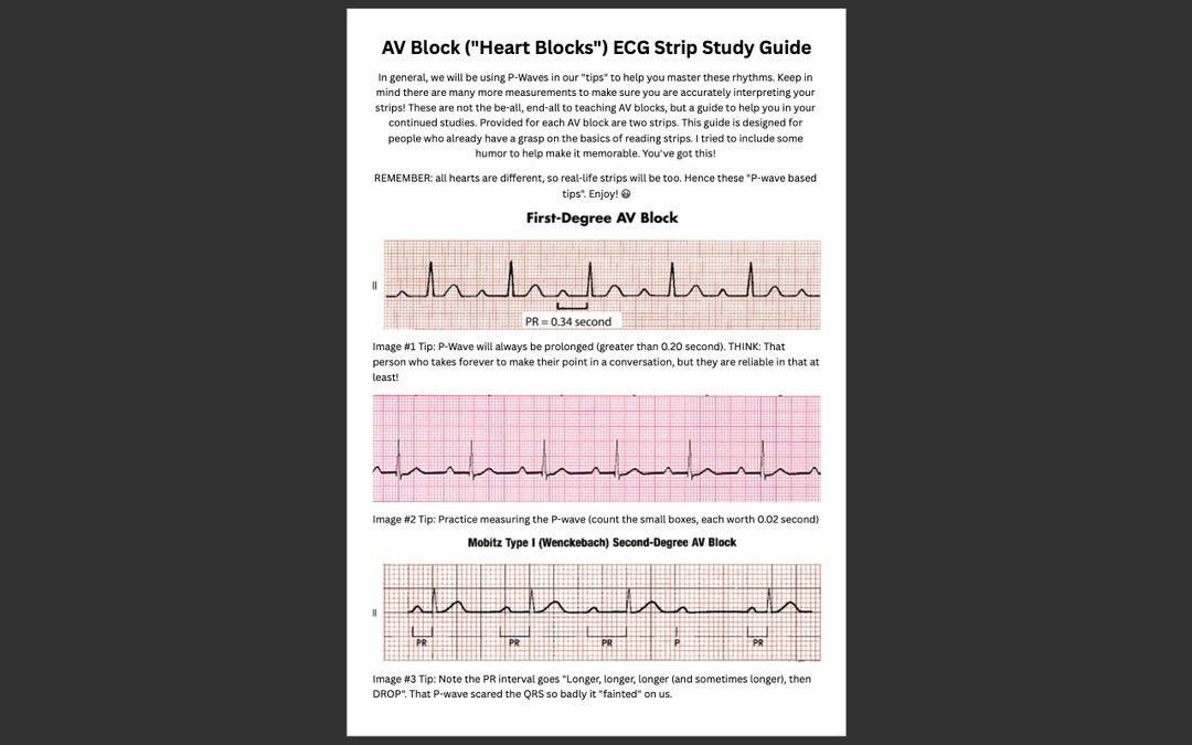 ECG/EKG AV Block (heart Block) Study Guide With Rhythm Strips - Etsy ECG/EKG AV Block (heart Block) Study Guide With Rhythm Strips - Etsy