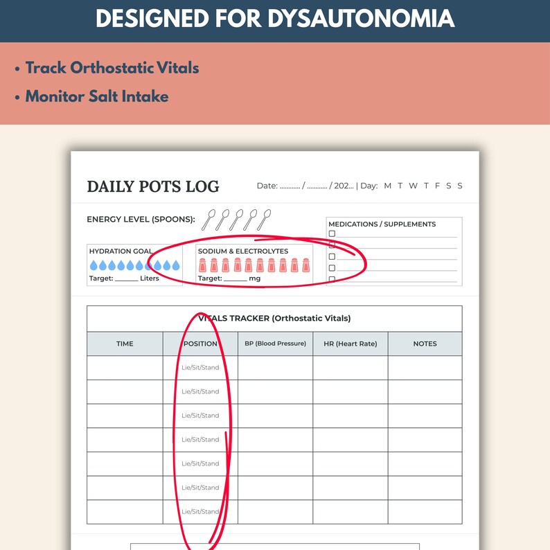 POTS Syndrome Journal Symptom Tracker | Dysautonomia Medical Binder ...