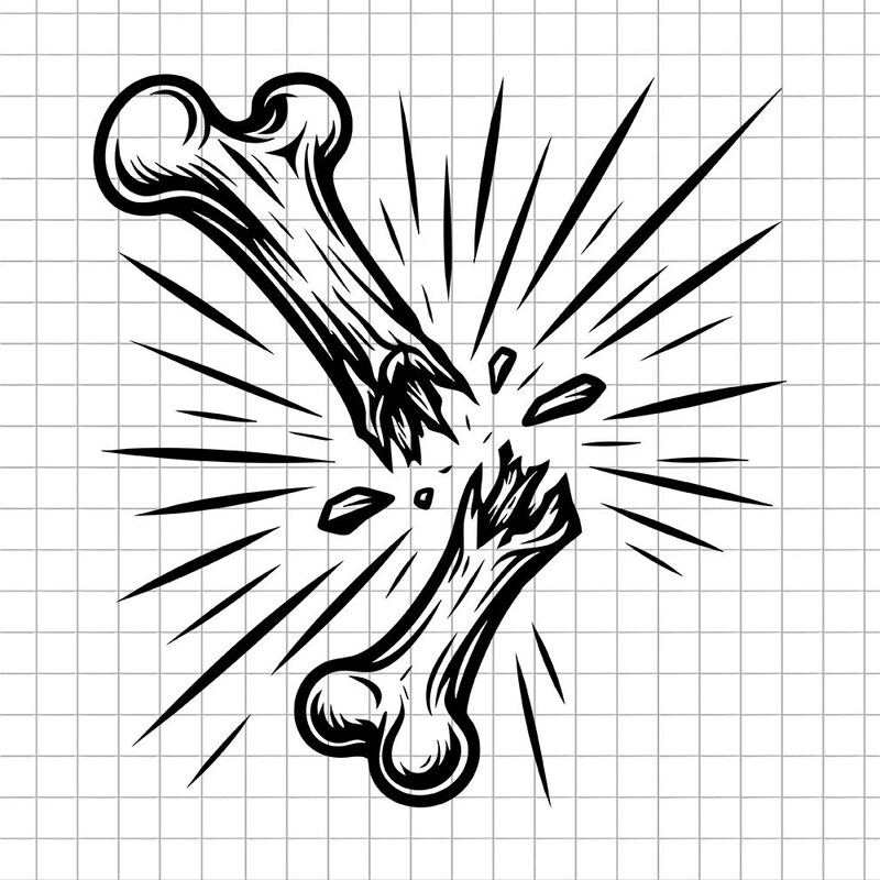 Broken Bone Svg - Etsy