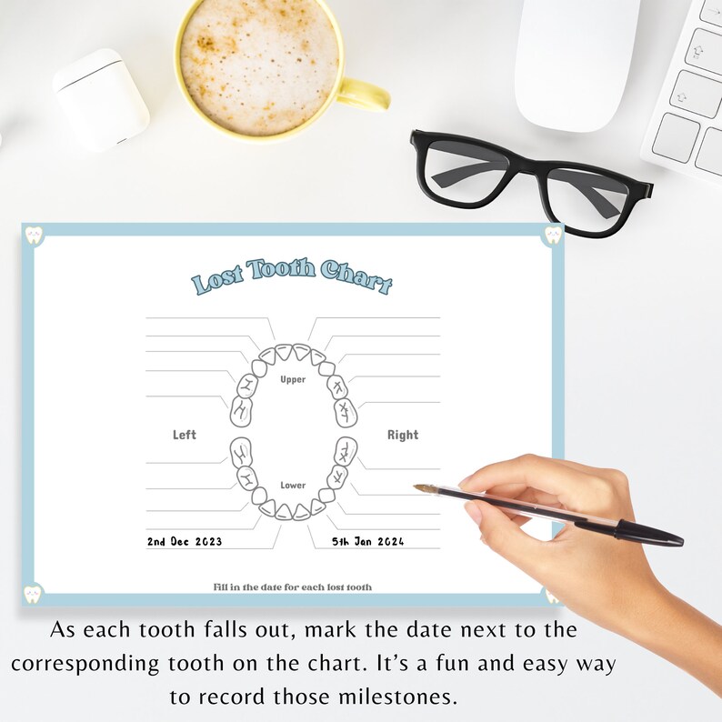 Printable Lost Tooth Chart Printable | Kids Tooth Tracker | Milestone ...