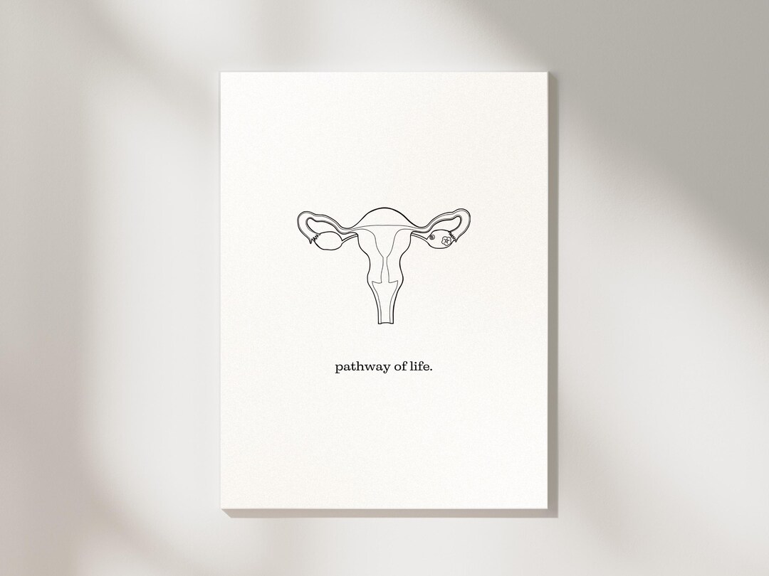 Fallopian Tube Wall Art | Medspa Decor | Medspa Wall Art | Botox Art ...