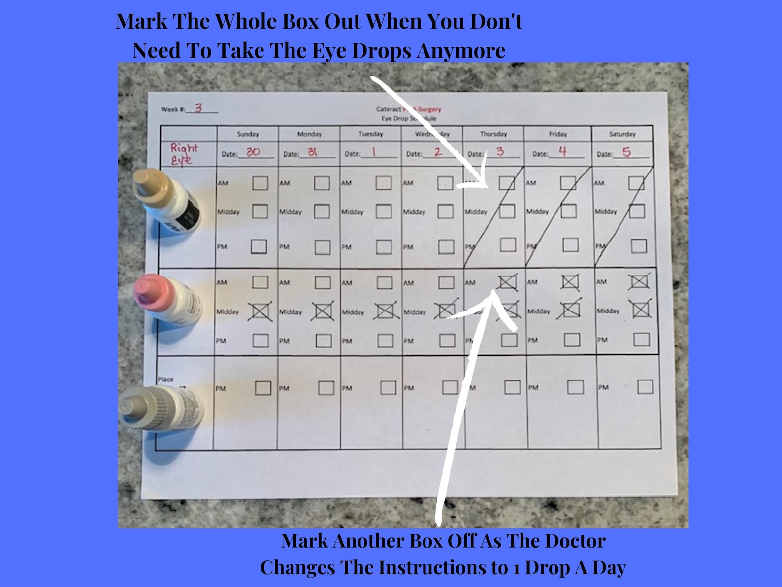 Eyedrop Cataract Surgery Eye Drop Tracker Eye Drop Schedule for ...