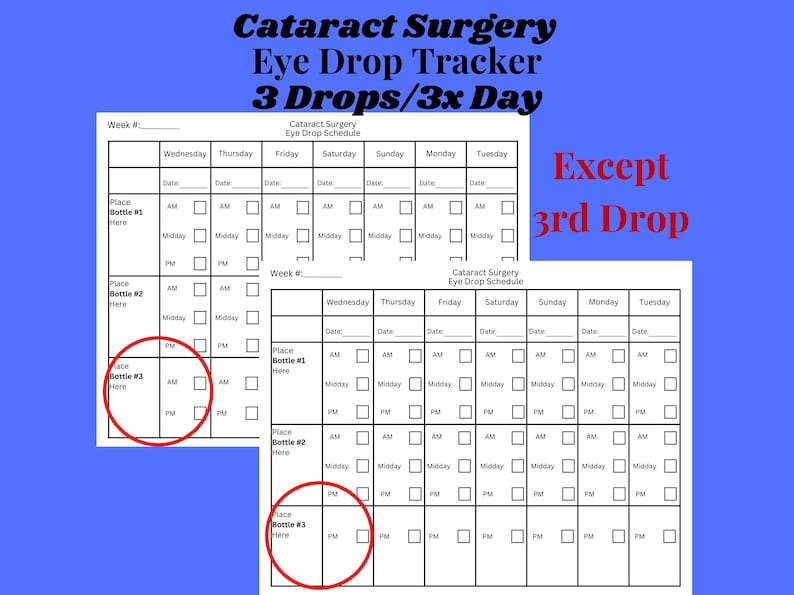 Eyedrop Cataract Surgery Eye Drop Tracker Eye Drop Schedule for ...