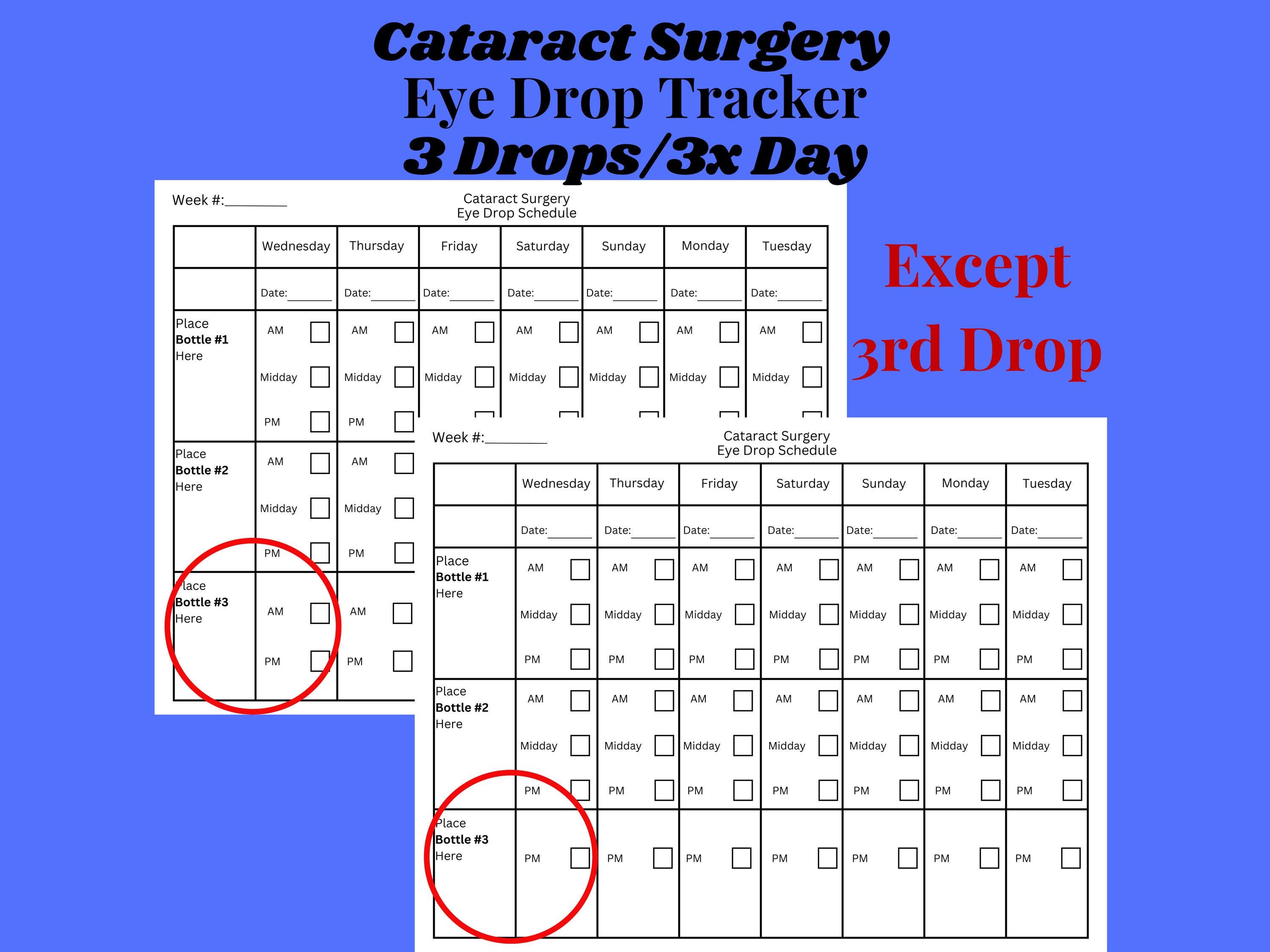 Eyedrop Cataract Surgery Eye Drop Tracker Eye Drop Schedule for ...